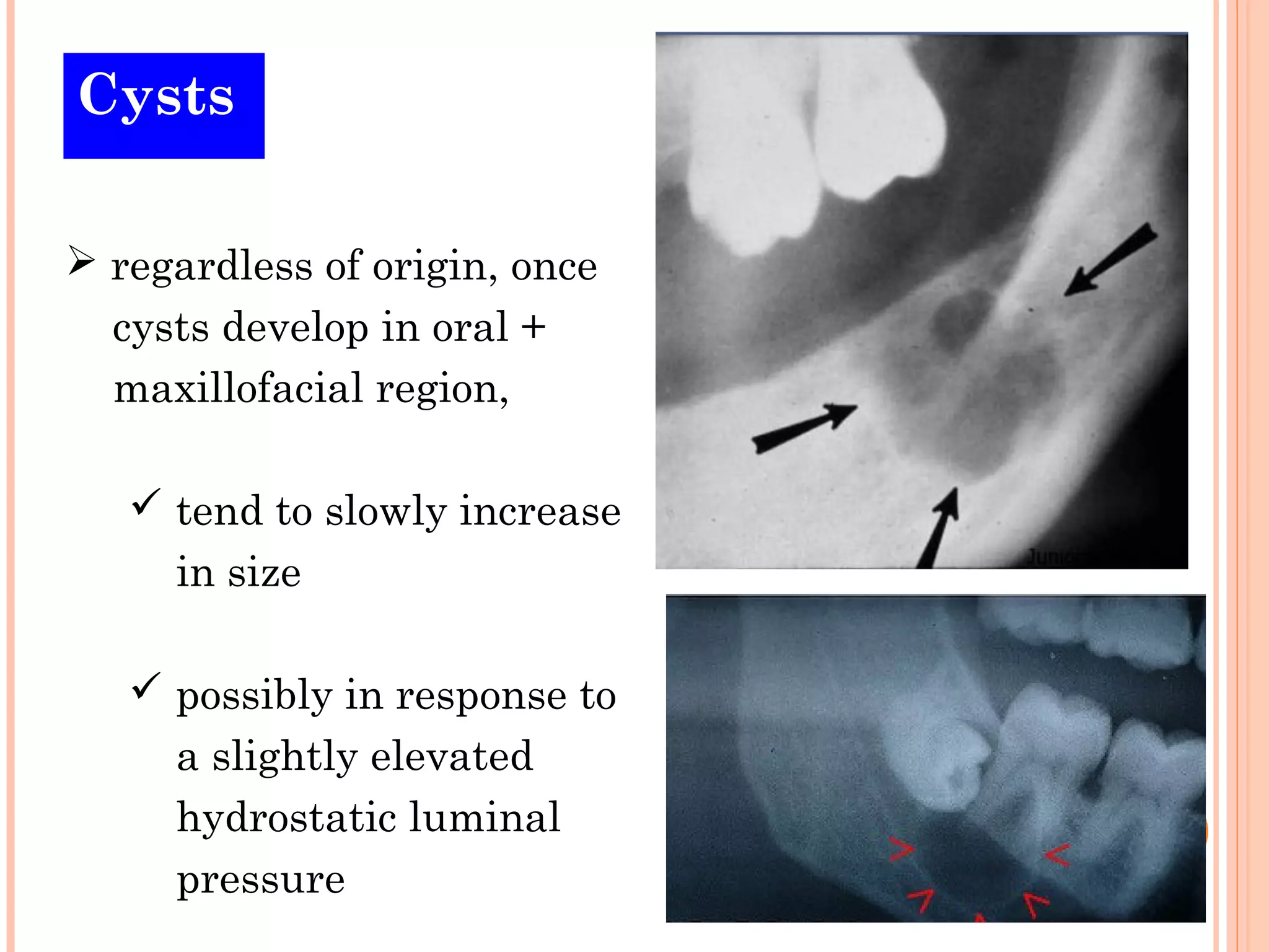 Cysts of oral region (5) | PPT