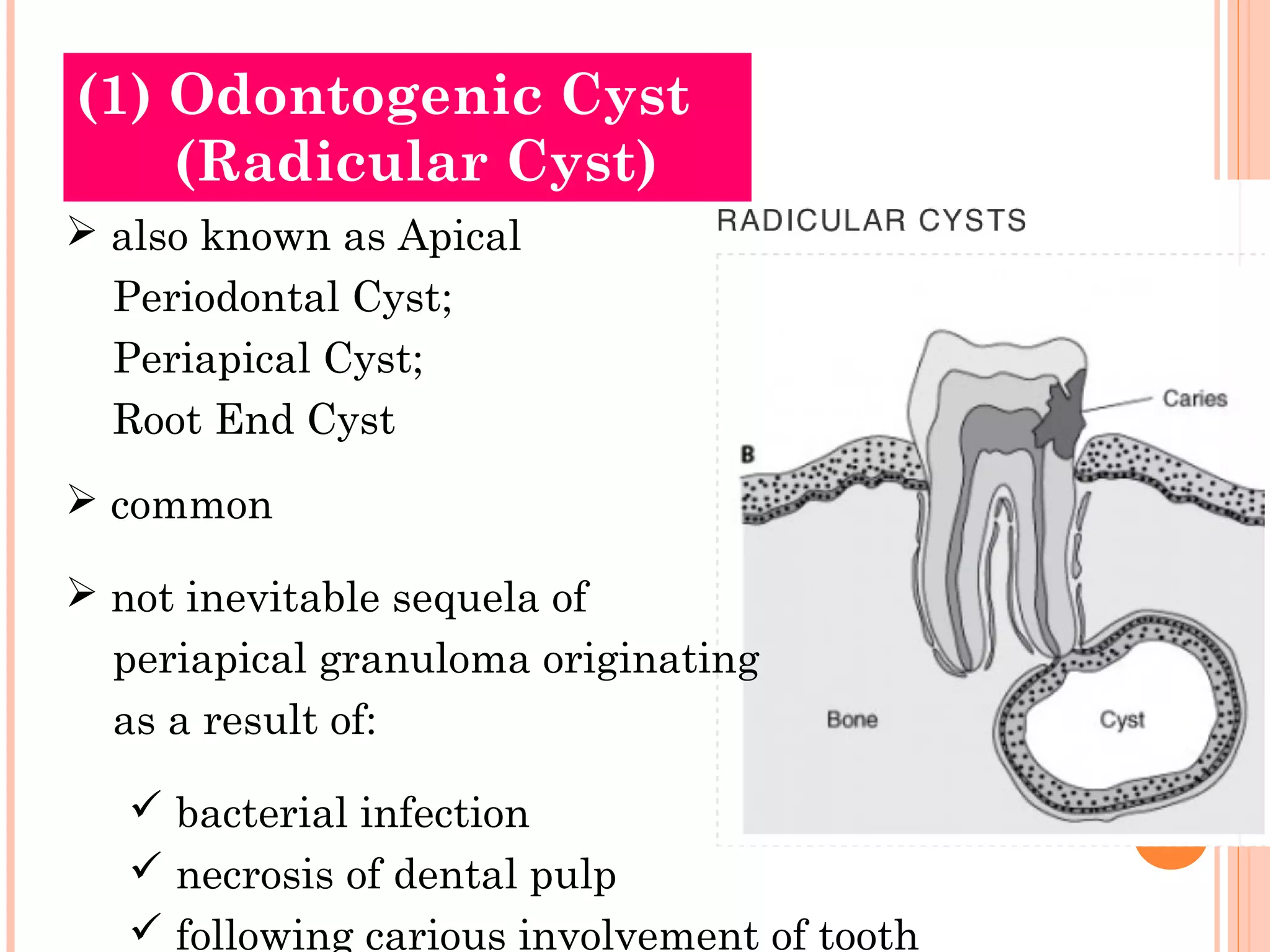 Cysts of oral region (5) | PPT