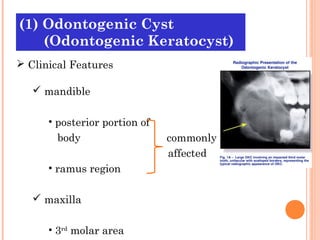 Cysts of oral region (5) | PPT