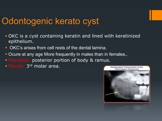 Cysts of oral regions | PPTX