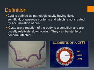 Cysts of oral regions | PPTX