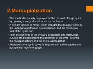 Cysts of oral regions | PPTX
