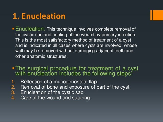 Cysts of oral regions