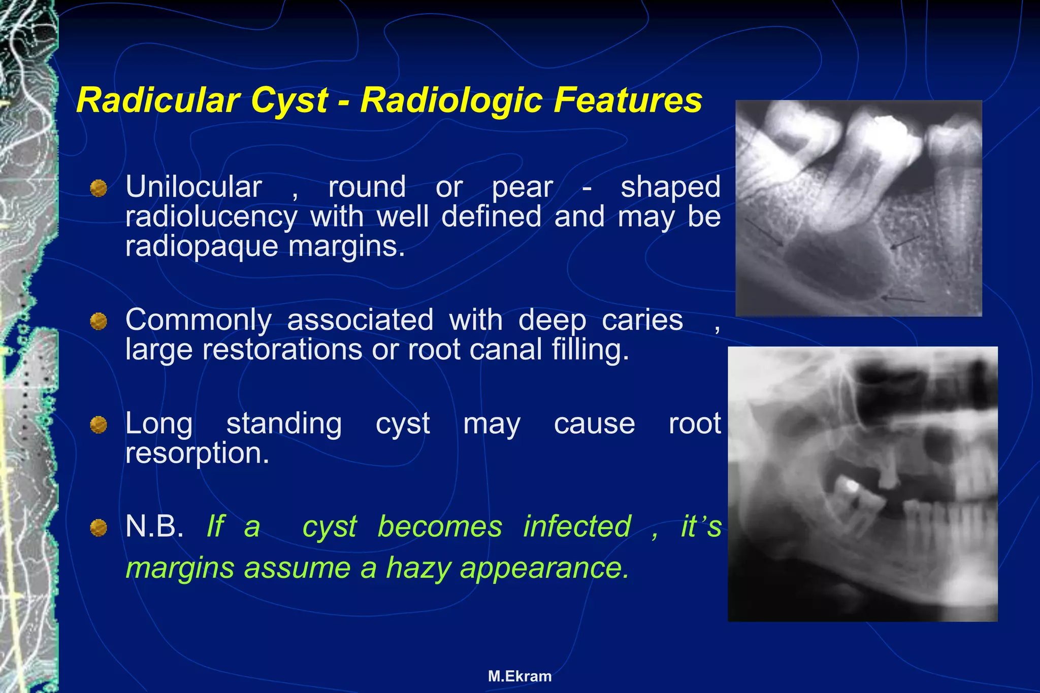 Cysts of the head and neck | PPT | Dental Health | Diseases and Conditions