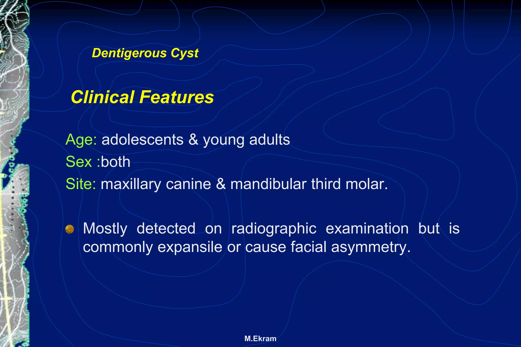Cysts of the head and neck | PPT