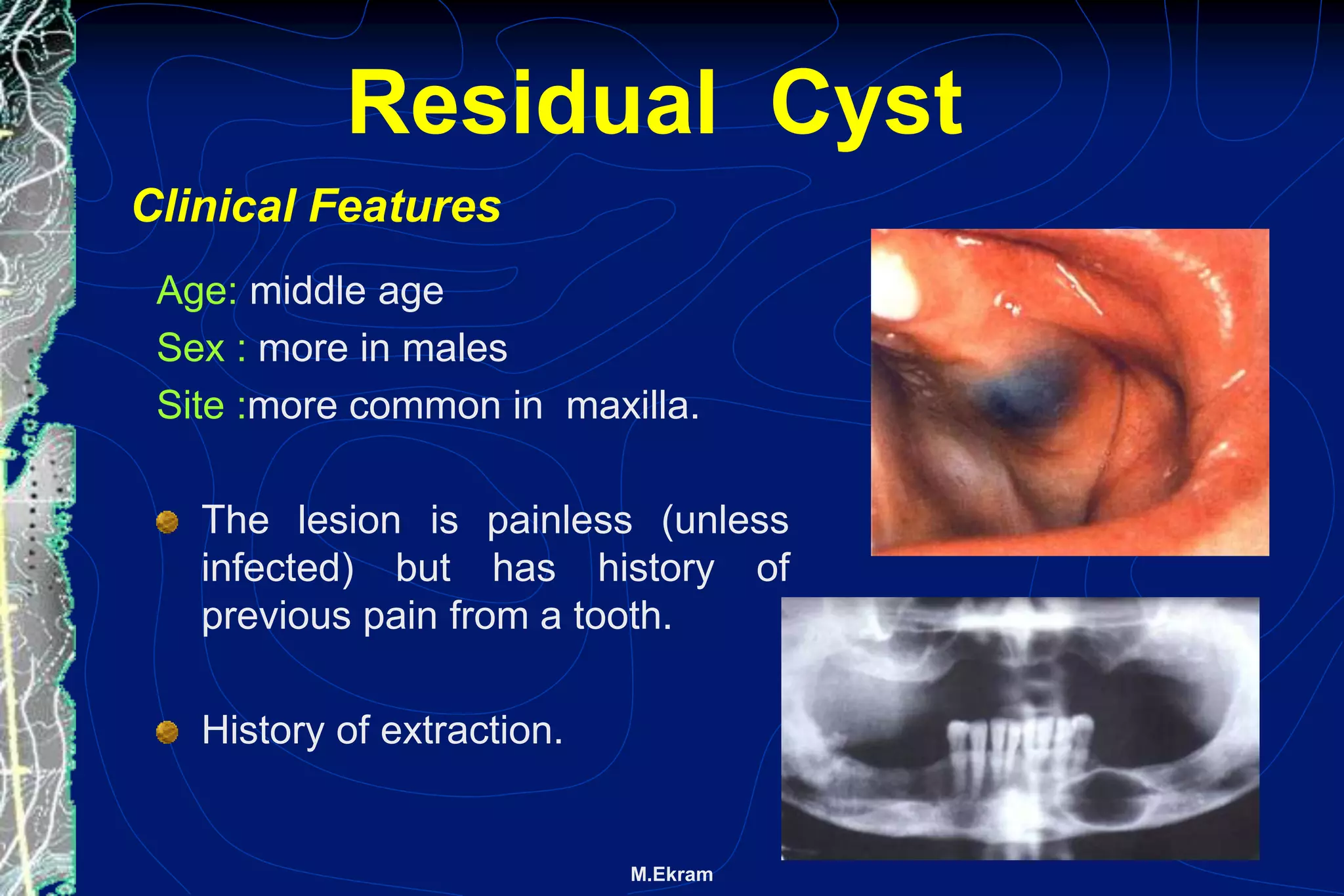 Cysts of the head and neck | PPT | Dental Health | Diseases and Conditions