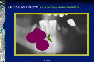 Cysts of the head and neck | PPT