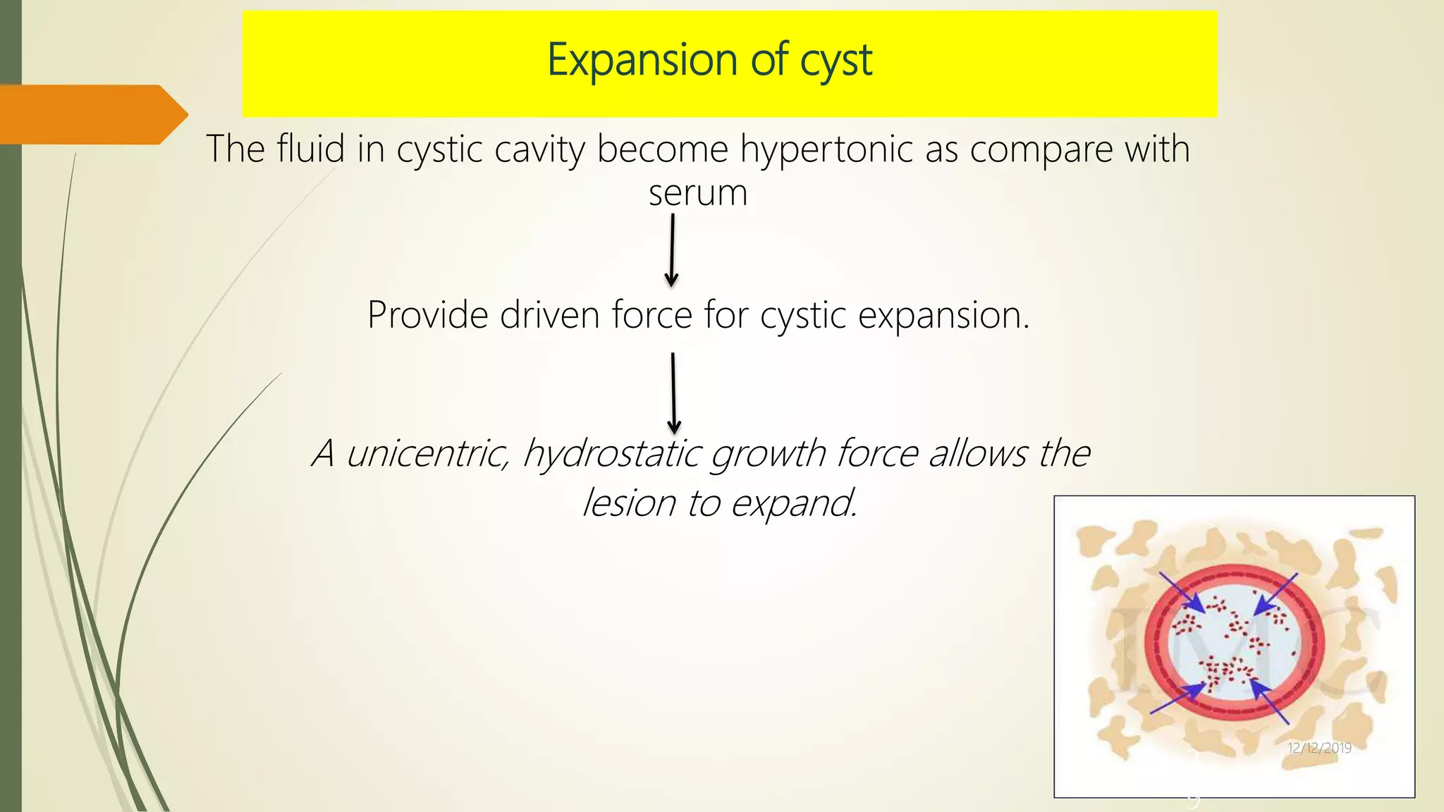 Cysts of the jaws | PPTX