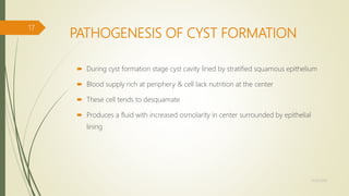 Cysts of the jaws | PPTX