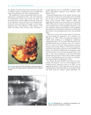 Cysts of the oral and maxillofacial regions -spear.seight_(2007) | PDF
