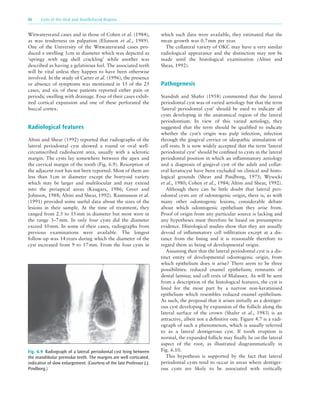 Cysts of the oral and maxillofacial regions -spear.seight_(2007) | PDF