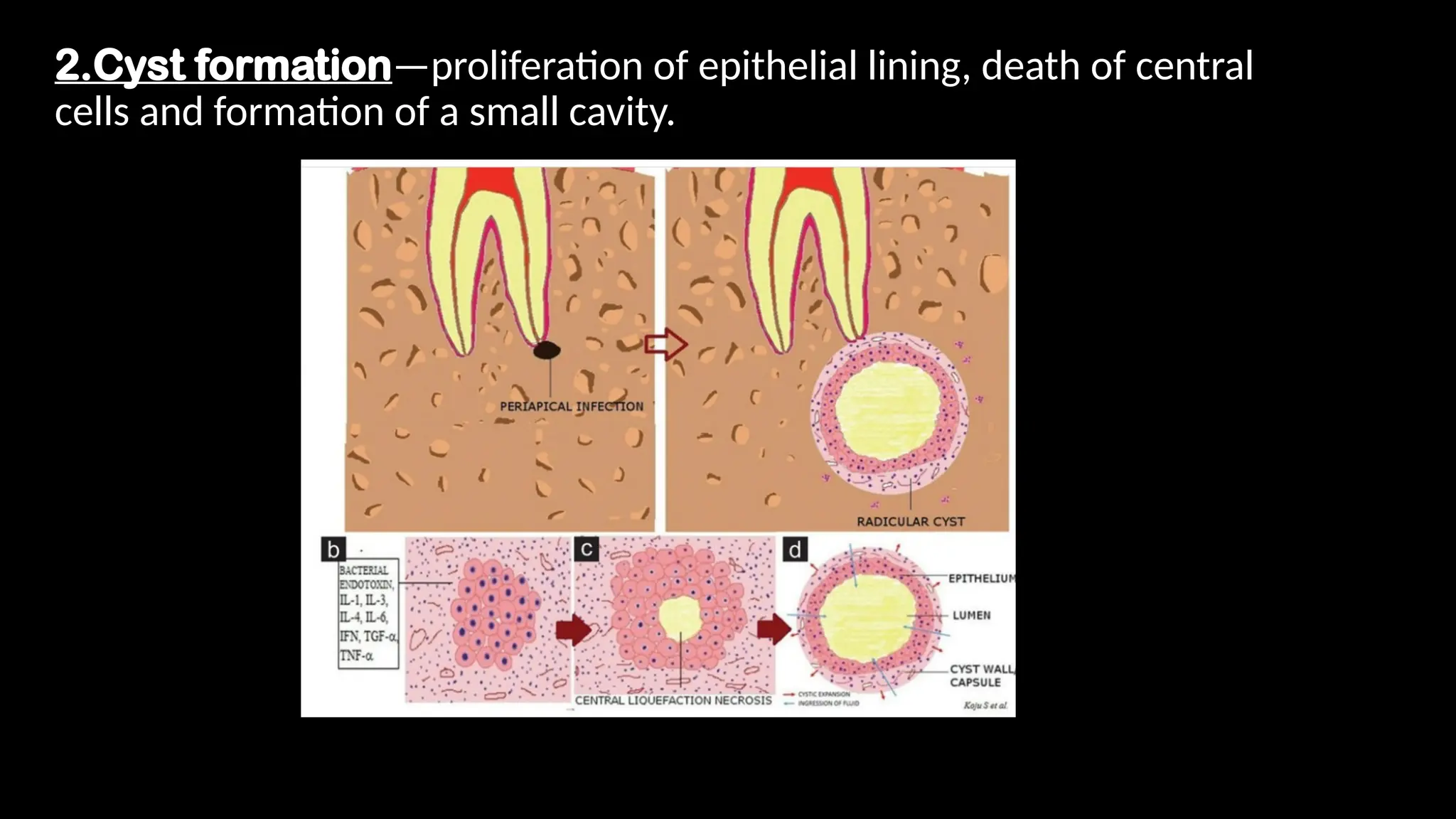 Cysts of the Oral Cavity maxillofacia.pptx
