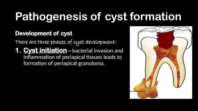 Cysts of the Oral Cavity maxillofacia.pptx