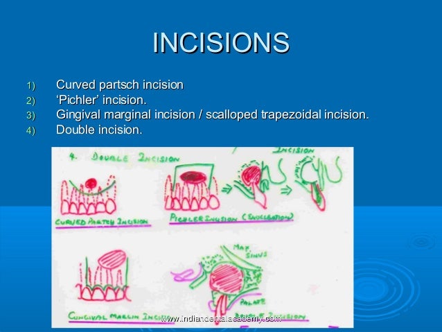 Cysts of the oral region / dental implant courses
