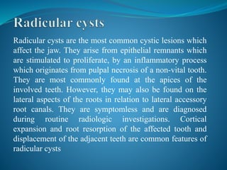 Cysts of the oral region | PPTX