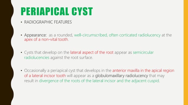 Cysts Of The Oral Region - Oral Pathology | PPTX