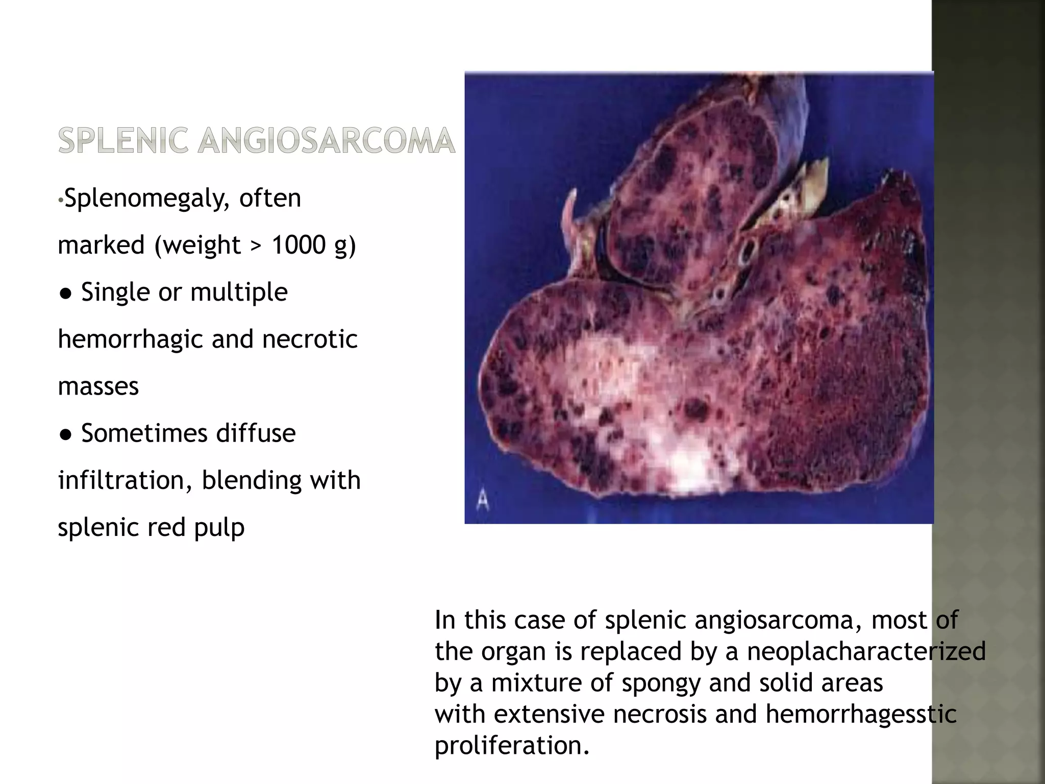 Cysts of the spleen | PDF