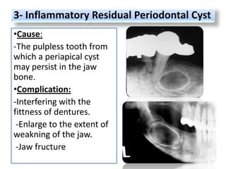 Cysts part 1 | PPTX