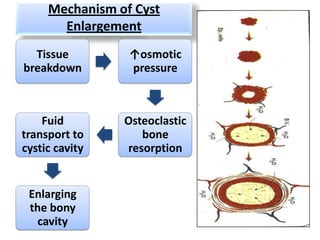 Cysts part 1 | PPTX