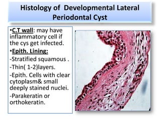 Lateral Periodontal Cyst Histology