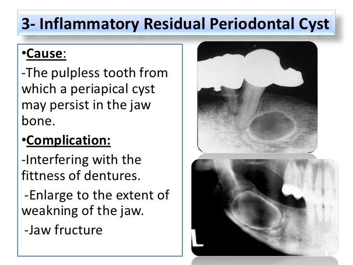 Cysts part 1
