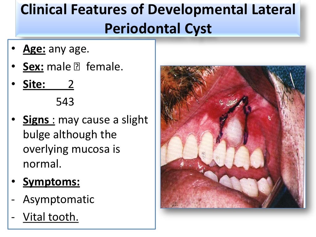 Cysts Part 1