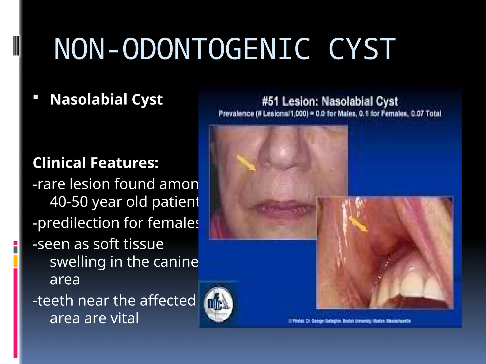 cysts of the jaws summary handout for students.pptx