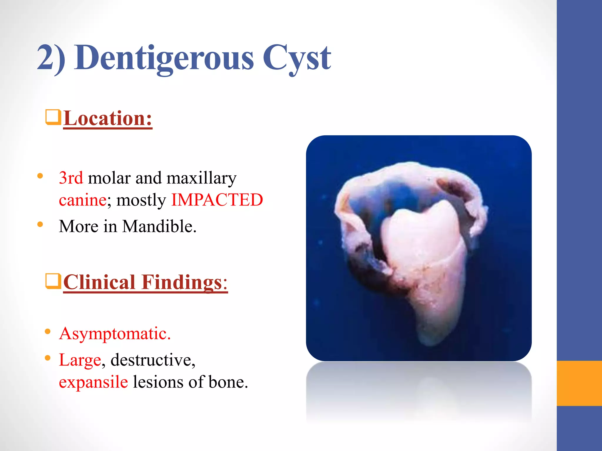 Cysts and tumors in pediatric dentistry | PPTX