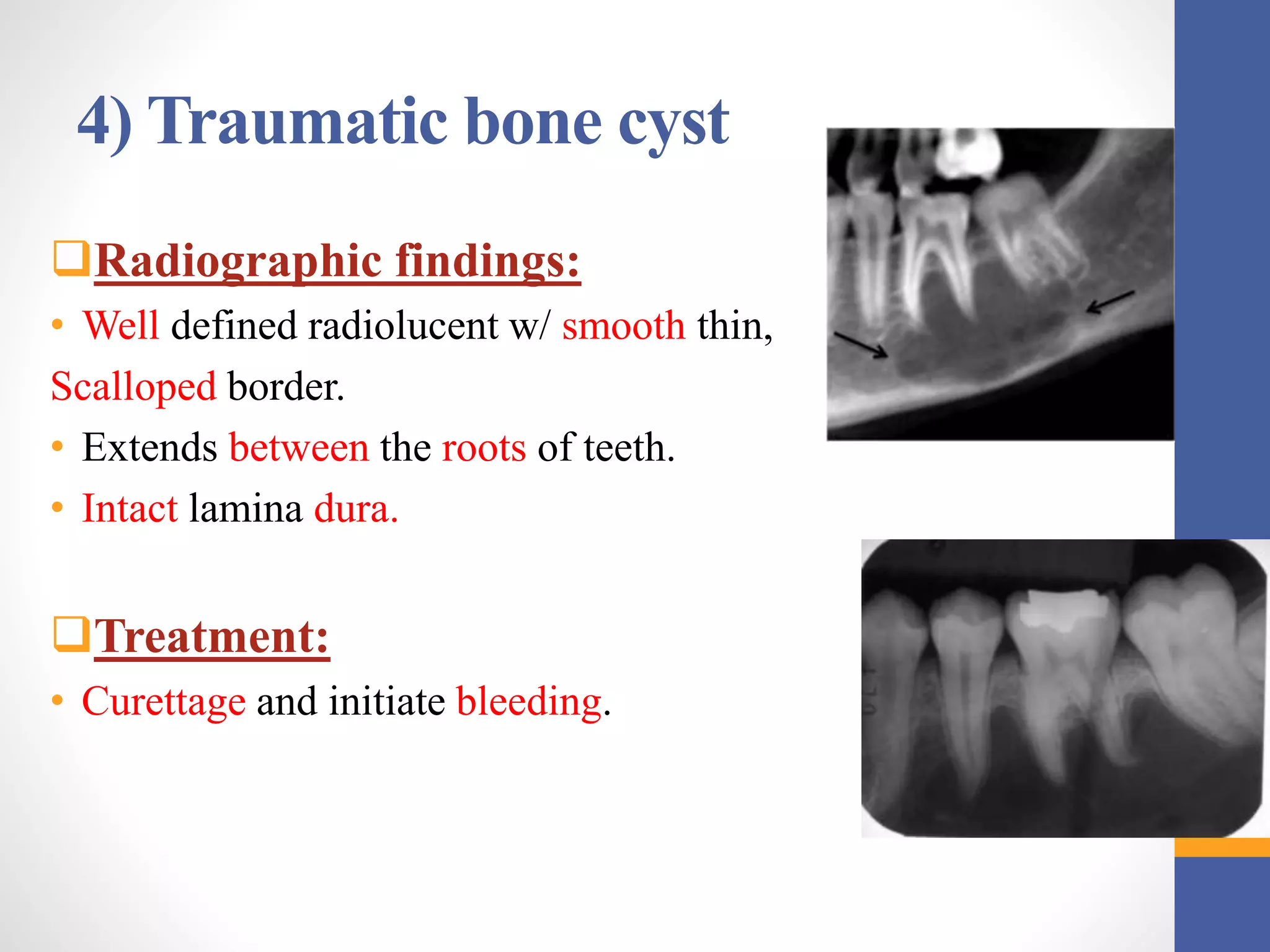 Cysts and tumors in pediatric dentistry | PPTX