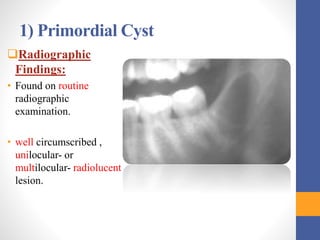 Cysts and tumors in pediatric dentistry | PPTX