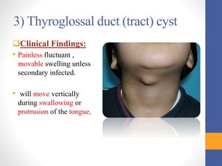 Cyst Under Chin