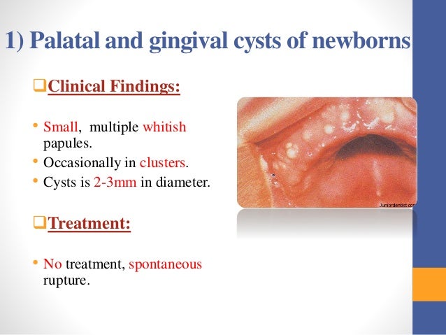 Cysts and tumors in pediatric dentistry