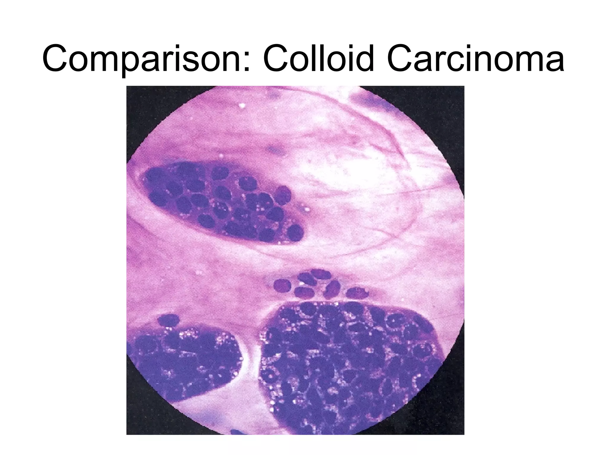 Cytopathology Conference 9/08/05 - Case 1 | PPT