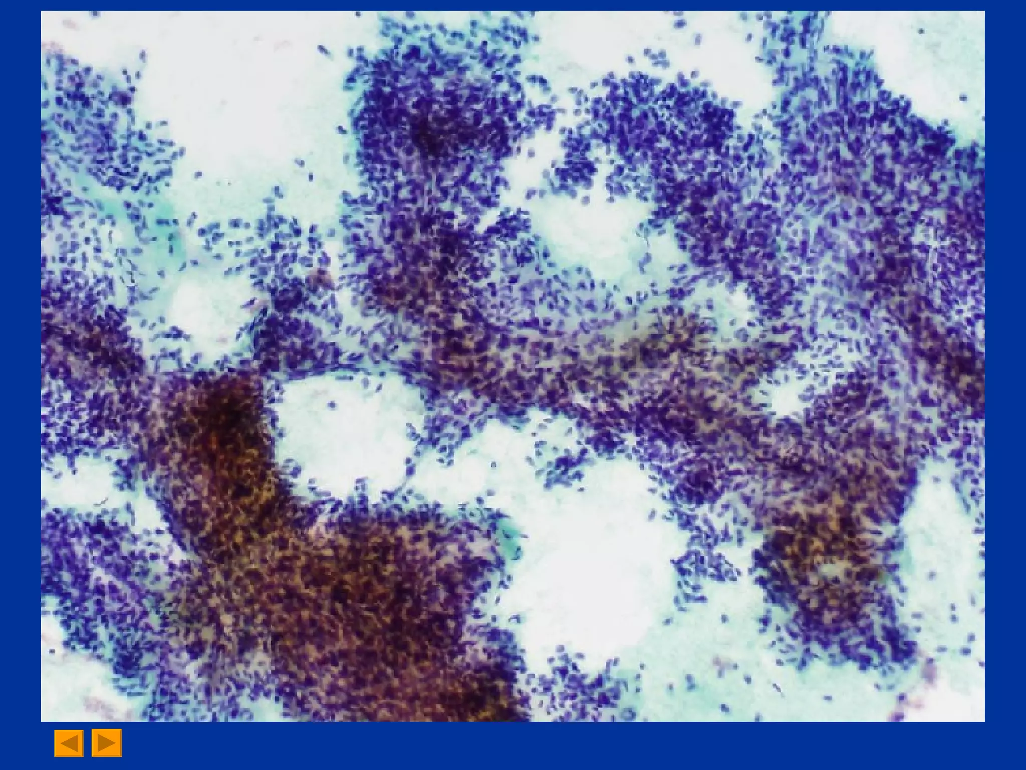 Cytopathology Conference 10/20/05 - Case 3 | PPT
