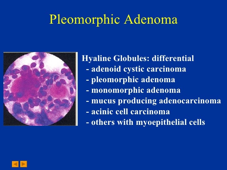 Cytopathology Conference 10/20/05 - Case 3