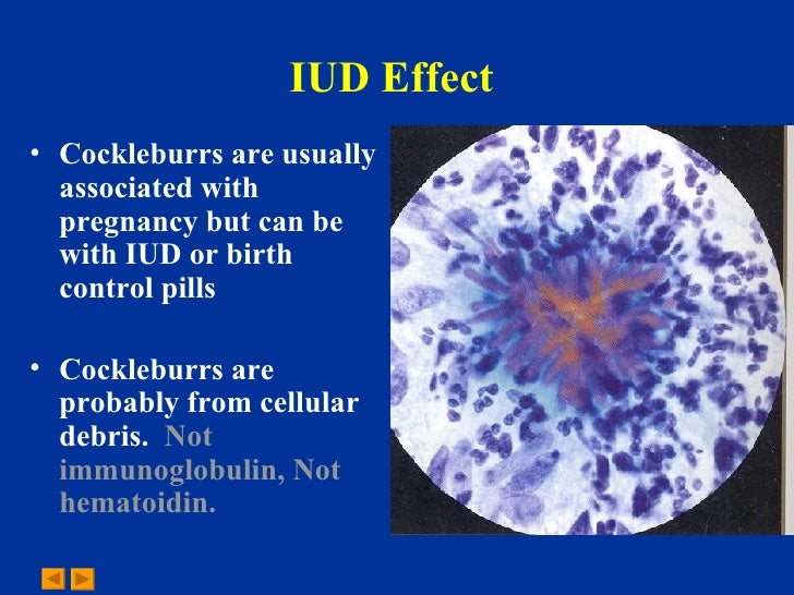Cytopathology Conference 12/01/05 - Case 2