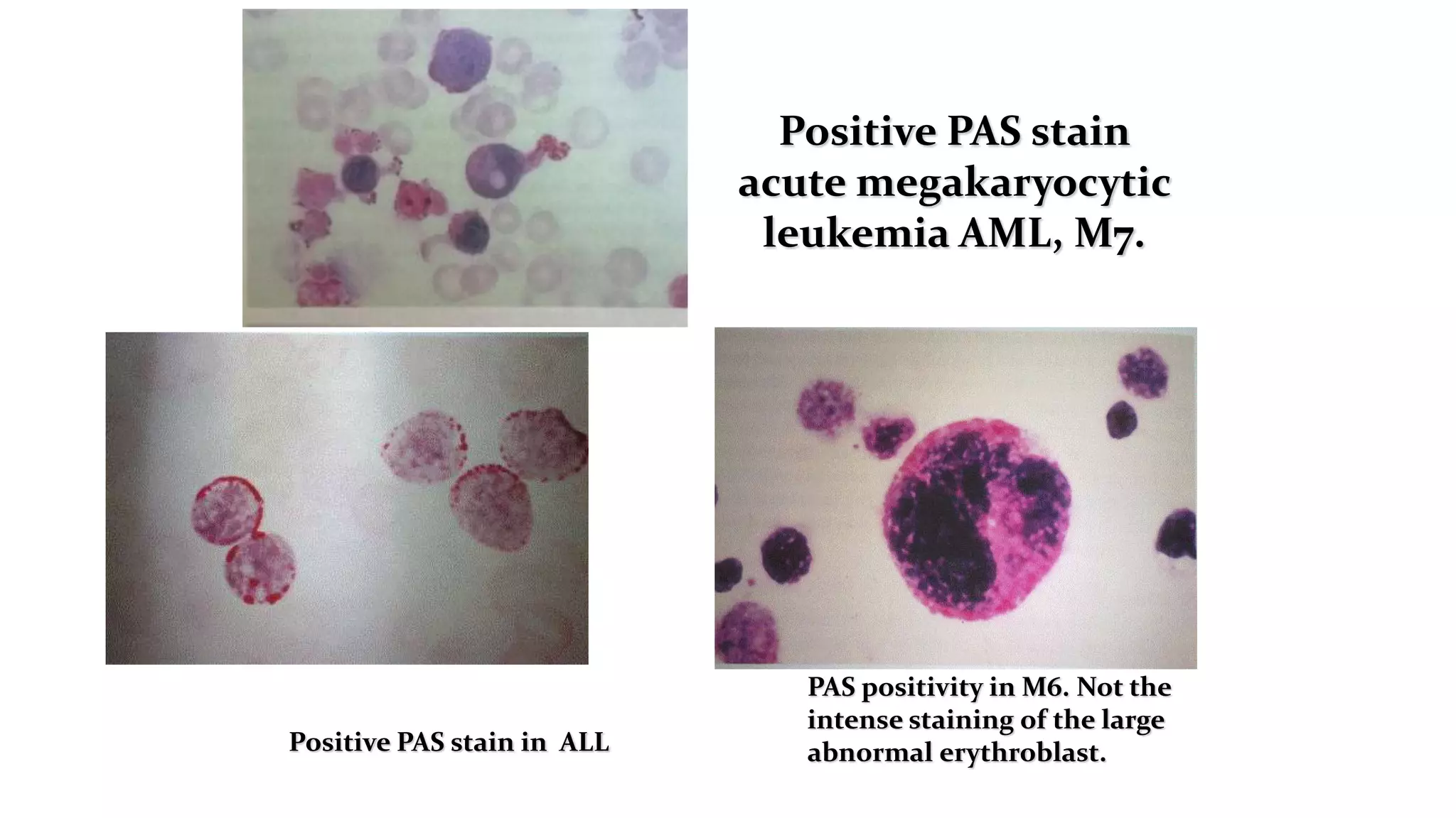 Cytochemical staining checked | PPTX