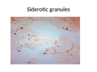 Cytochemistry Stian.ppt heamatology leukemia of white blood cells | PPT