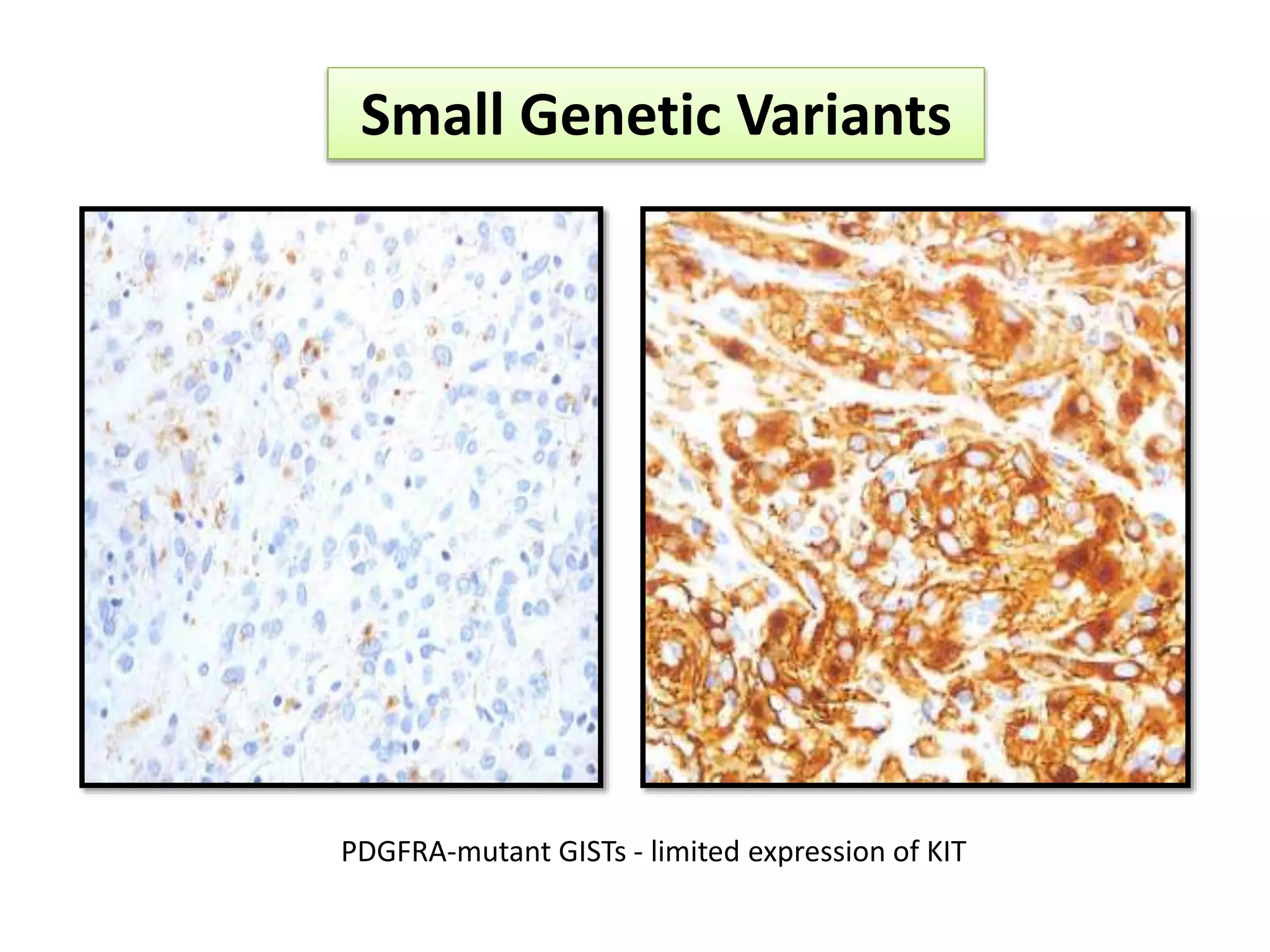 Cytogenetic and molecular pathology of soft tissue tumours | PPTX