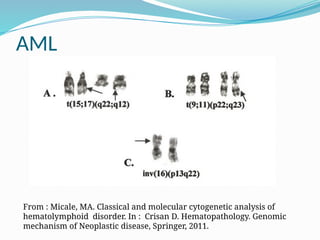 Cytogenetic Examination of Leukemia.pptx