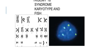 Cytogenetics in diagnosis of disease | PPTX