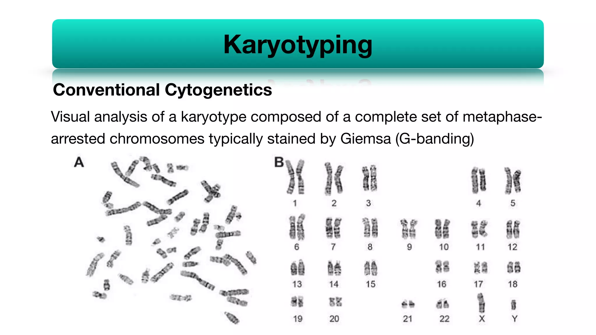 Cytogenetics in Acute Leukemias.pdf