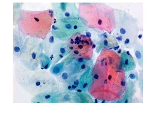 Cytological tests | PPTX | Lung and Respiratory Health | Diseases and ...