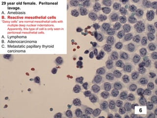 cytology-cases-september-1.ppt