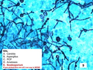 cytology-cases-september-1.ppt