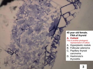 cytology-cases-september-1.ppt