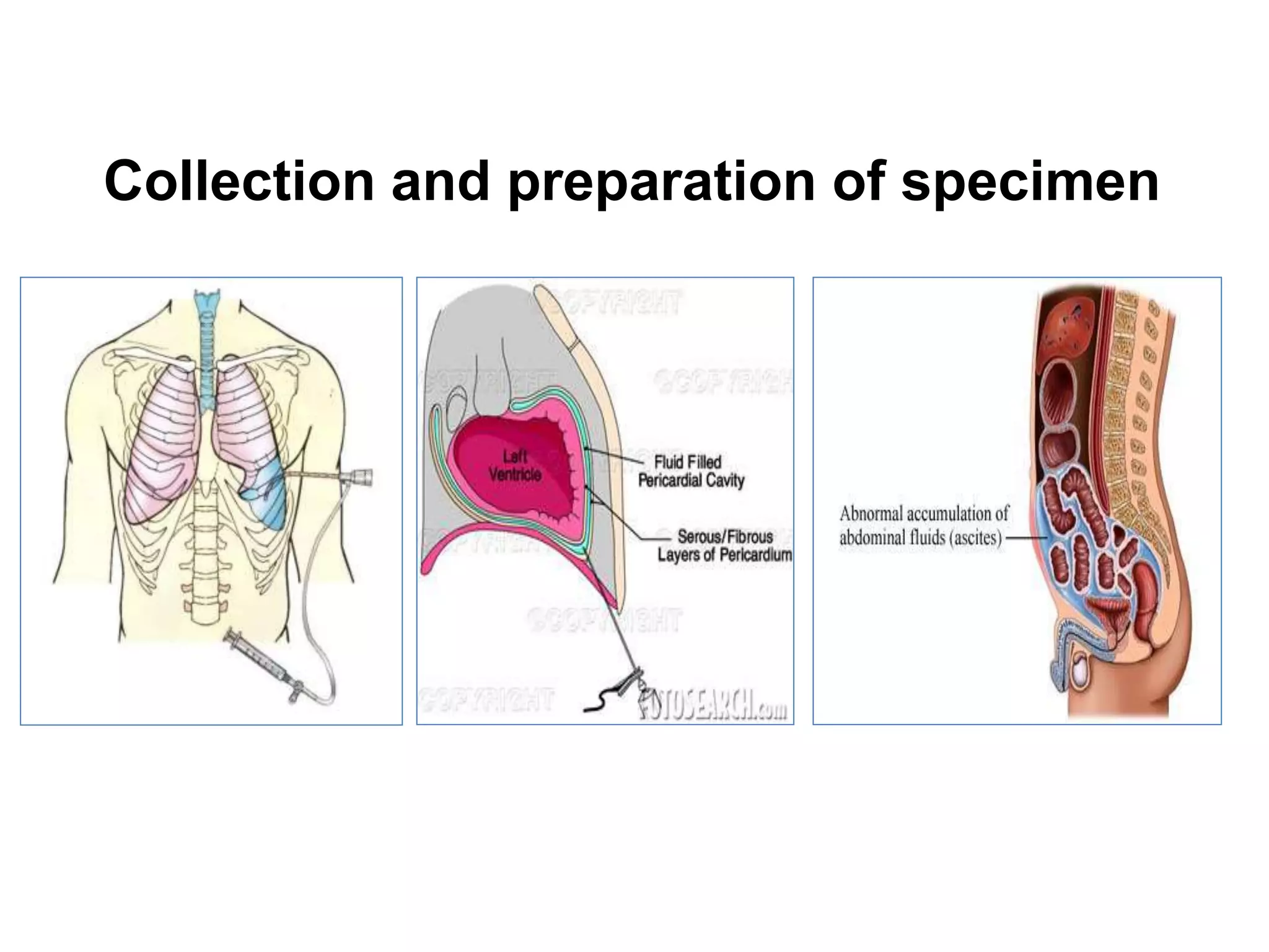 Diagnostic Cytology Introduction Body Fluids Cytology Pptx 5578