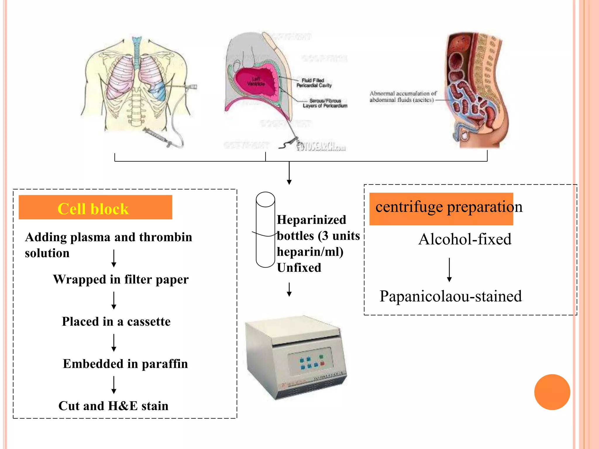 diagnostic Cytology introduction , Body fluids cytology | PPTX