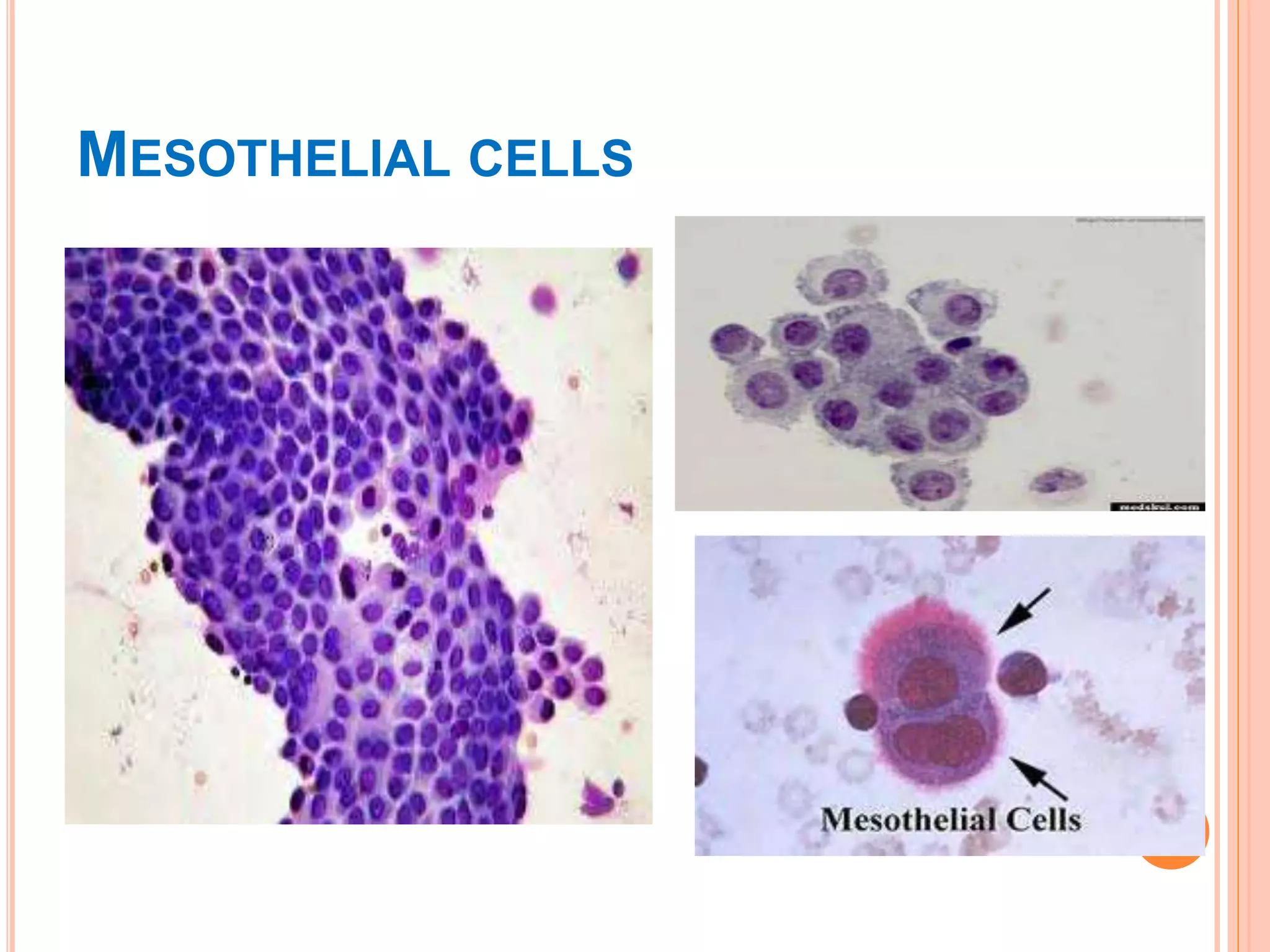diagnostic Cytology introduction , Body fluids cytology | PPTX