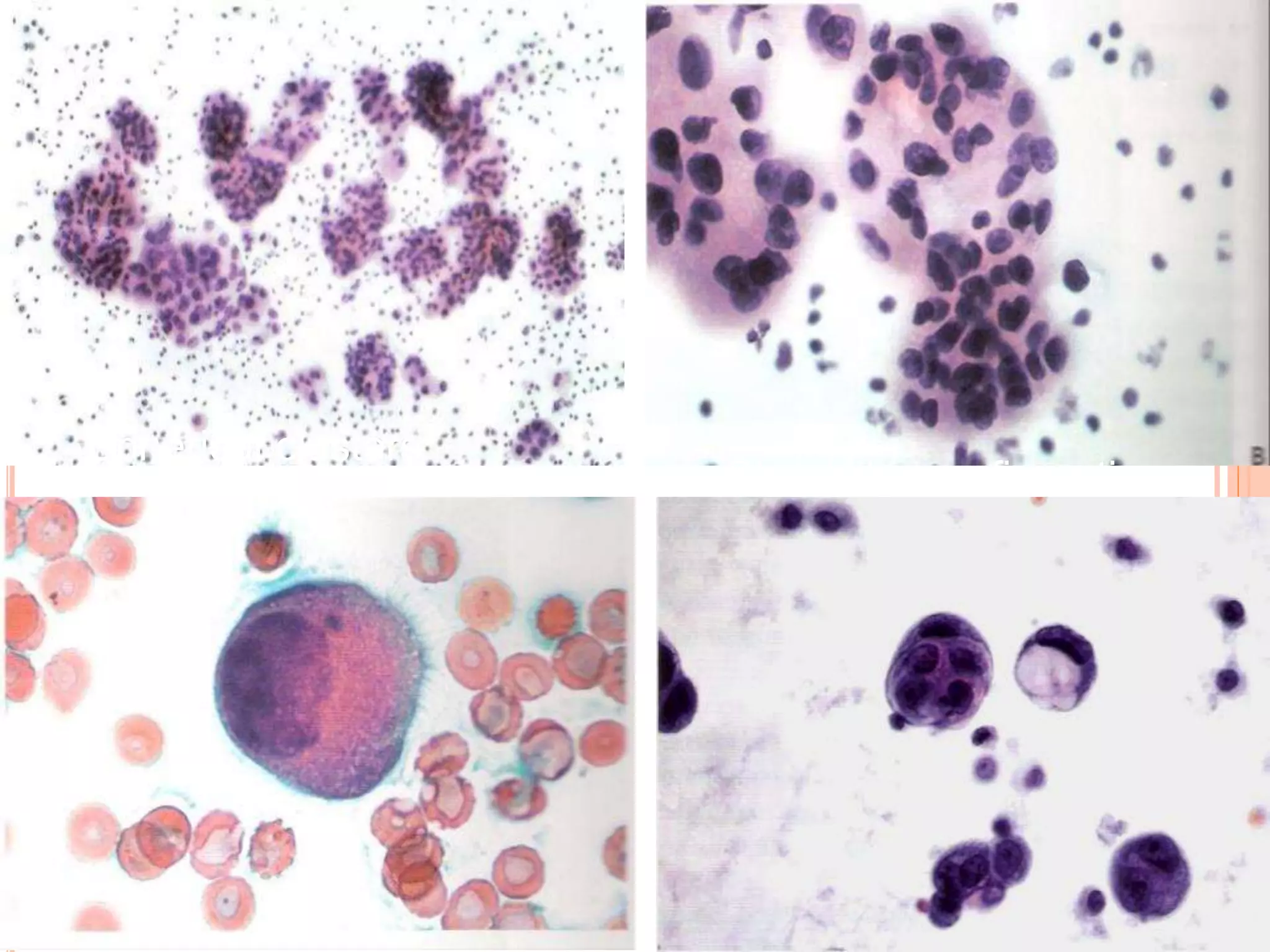Diagnostic Cytology Introduction Body Fluids Cytology Pptx 5800